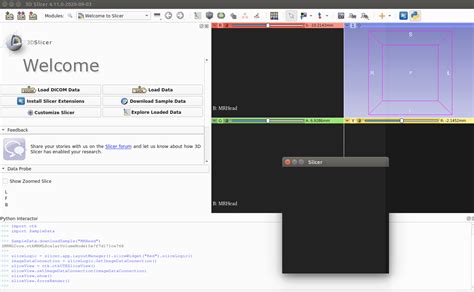 Vtk 9 Slicer Viewer Do Not Show The Slice · Issue 5220 · Slicerslicer · Github