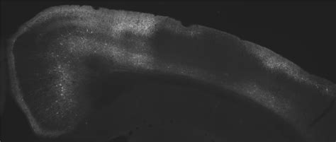 Switching Between Egocentric And Allocentric Coordinates Sainsbury Wellcome Centre