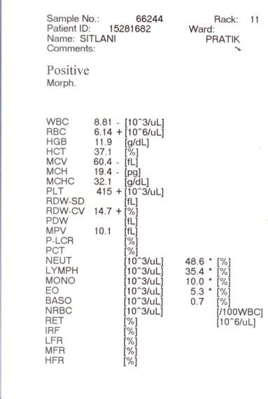 Microcytic Hypochromic Anemia Blood Smear And CBC Reports Medical Laboratories