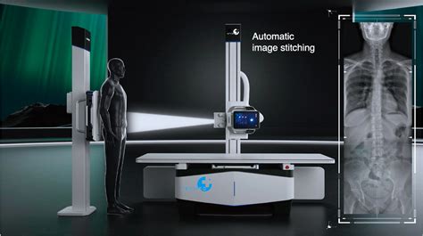 Revolutionizing Healthcare With Digital X Ray Radiography Systems
