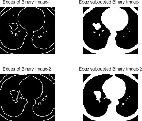 Figure 6 From Lung Cancer Detection And Classification Using Ct Scan Image Processing Semantic