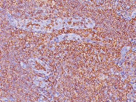 Cd45ro Antibody Biocare Medical