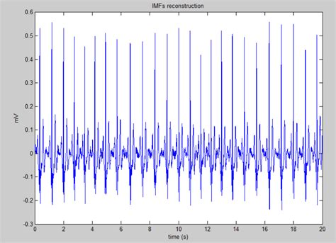 Github Ramiro Gm Cardiac Frecuency And Ecg Signal Denoising By Eemd Ecg Signal Denoising