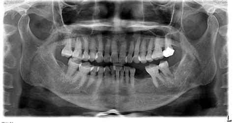 Adjusted Thesis Project Object Detection Dataset By Skripsiselesai