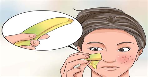 10 Easy Home Remedies To Shrink Large Pores Quickly