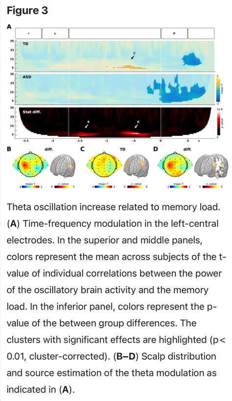 working memory tasks in autism correlated to reduced alpha waves during