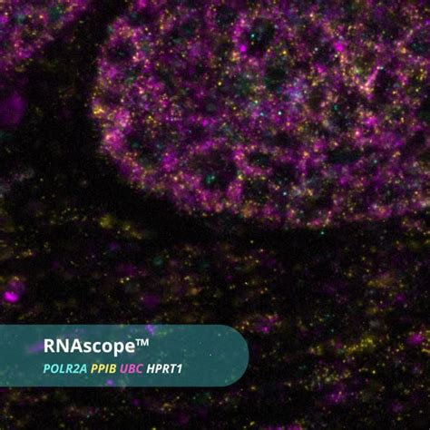 Lunaphore On Linkedin Multiomics Lunaphore On Linkedin Multiomics