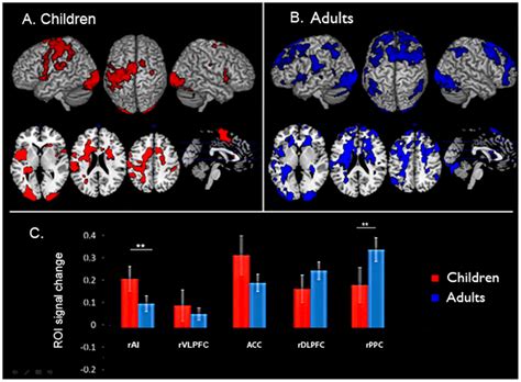 Brain Activation In The Salience Network Sn And Central Executive Download Scientific Diagram