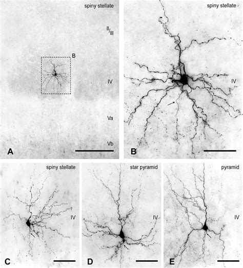 Prickle Cell Layer Of Epidermis Semantic Scholar