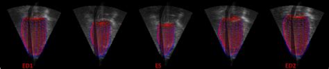 Lv Segmentation Over The Cardiac Cycle Using The Proposed Approach Download Scientific Diagram