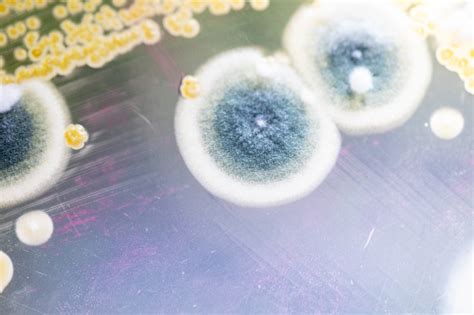 곰팡이 아름다운 실험실 미생물학에서 배양 매체 판에 곰팡이 의 특성의 식민지 0명에 대한 스톡 사진 및 기타 이미지 0명 건강 검진 건강관리와 의술 Istock