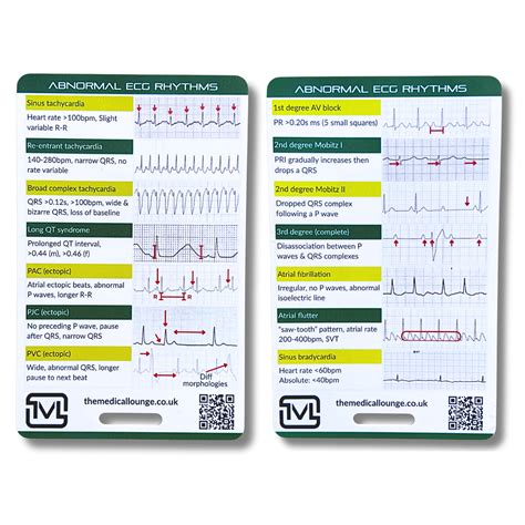 Abnormal Ecg Rhythms Interpretation Reference Card The Medical