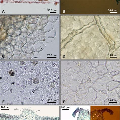 Salvia Divinorum Non Glandular Trichomes Light Microscopy A