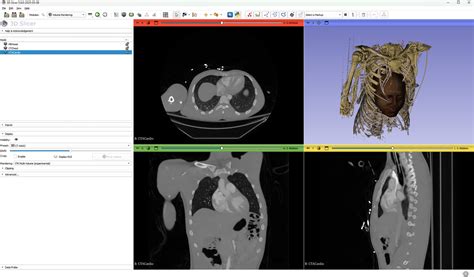 Multivolume Rendering Support 3d Slicer Community
