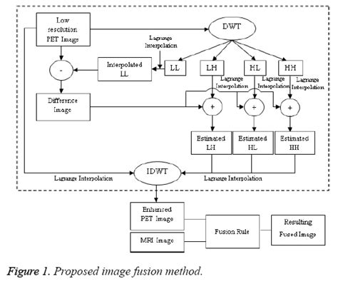 Brain Tumour Detection Using Discrete Wavelet Transform Based Medical
