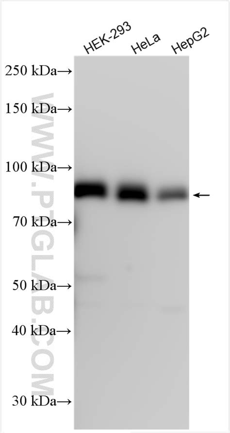 Uvrag Antibody 31105 1 Ap Proteintech