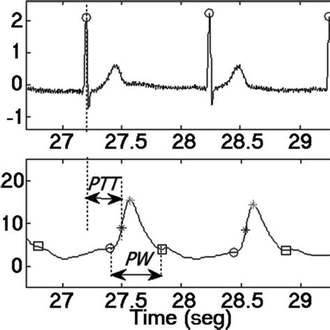 Ecg And Ppg Signal With Ptt And Pw Representation 70 Download