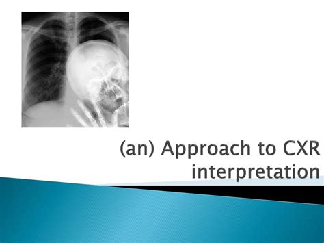 Ppt An Approach To Cxr Interpretation Powerpoint Presentation Free Download Id 2048554