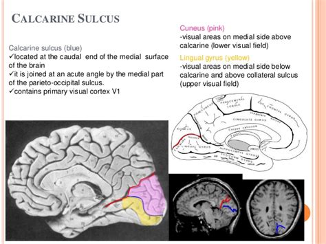 EXAMS AND ME Calcarine Sulcus