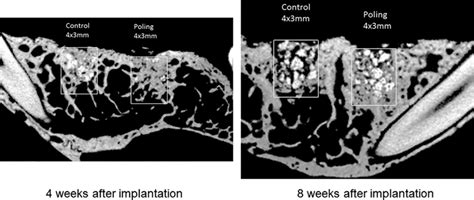 μct images taken in the sagittal section to visualize the bone hole