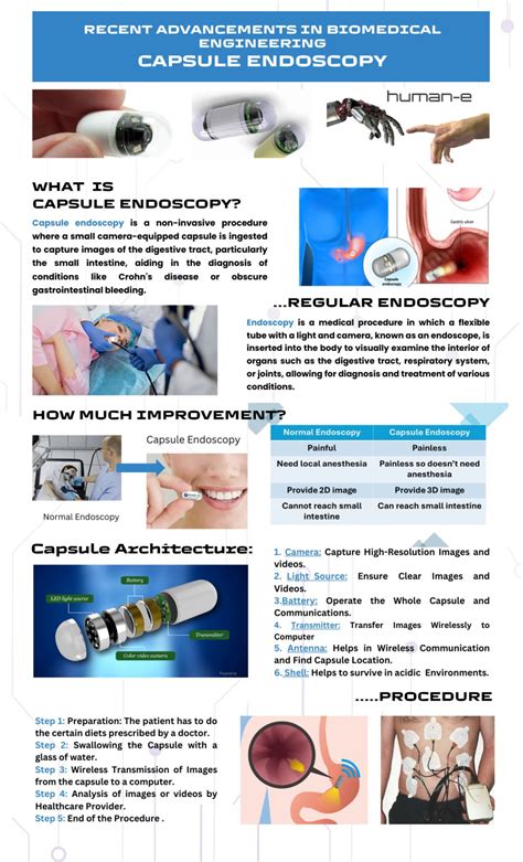 First Time Designed A Poster On Capsule Endoscopy Capsule Endoscopy Is