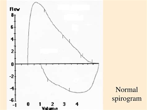 Spirometry Test Emphysema At Mae Burley Blog