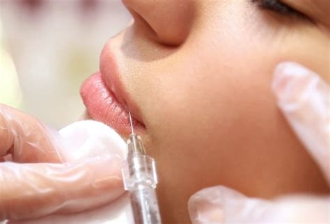 The Science Behind Botox And How It Works Stay Healthy Blog
