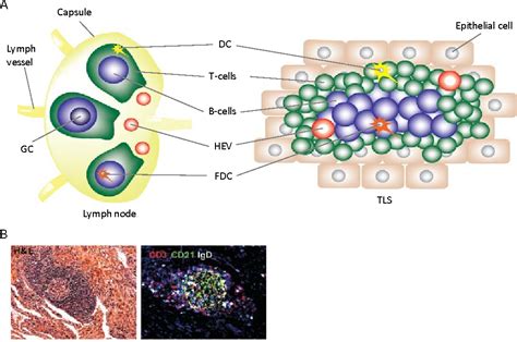 Figure 1 From Role Of Tertiary Lymphoid Structures Tls In Anti Tumor