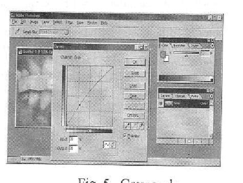 Figure 5 From New Method Using Image Analysis To Measure Gingival Color Semantic Scholar