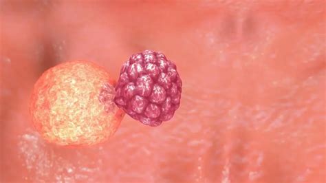 Assisted Hatching For Embryo Implantation