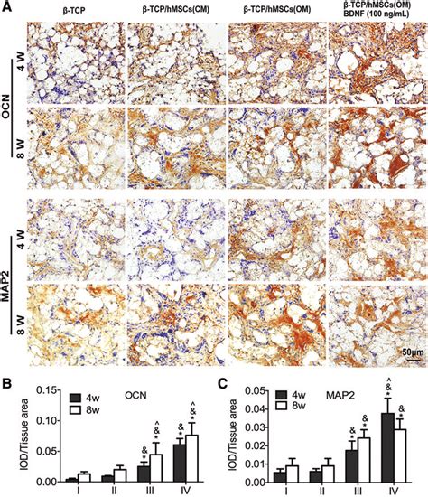 immunohistochemical staining of ocn and map2 a immunohistochemical