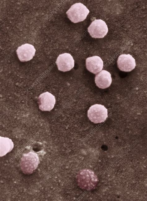 Cell Infected With Hiv Sem Stock Image C009 7537 Science Photo Library