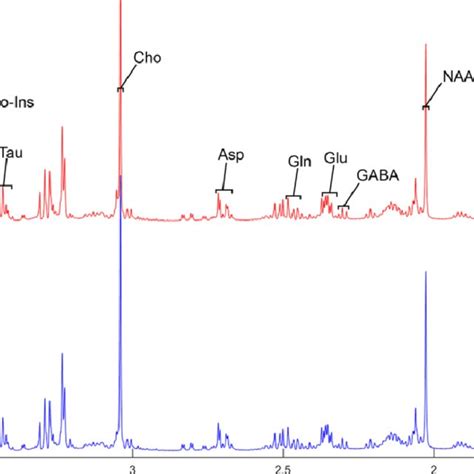 The Normalized 1 H Nmr Spectra Of Extracts In The Striatum After Miri