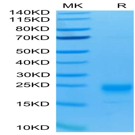 Human Il 5 Protein Il5 Hm401 Kactus Biosystems Ushelf
