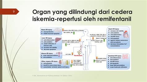 Remifentanyl Perioperatif For Sedation Pptx