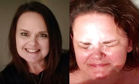 Before And After Facials Photo X Vid Com