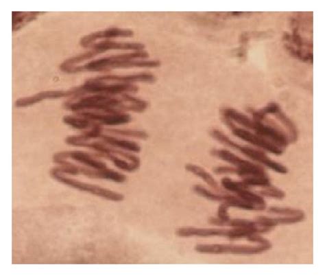 Chromosomal Aberrations And Nuclear Irregularities Observed In Root Tip Download Scientific