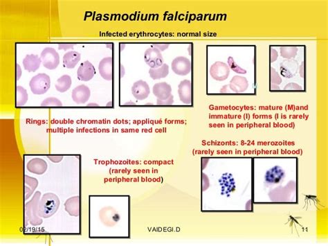 Plasmodium Species