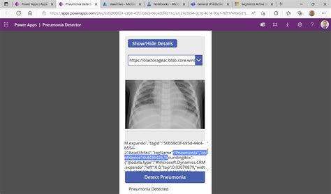 Github Olajideajayipneumonia Prediction Model