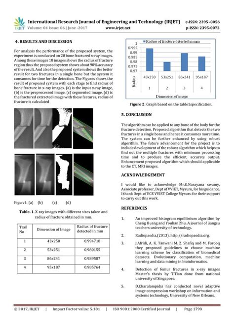 automatic detection of radius of bone fracture pdf