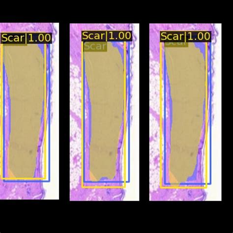 scar identification with mask rcnn using various backbones a whole download scientific