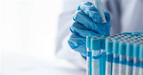 New Temperature Monitoring Methods Safeguard Clinical Trials And Biosamples Swift Sensors