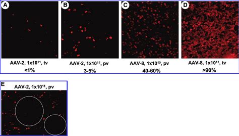 Figure 1 From Improved Induction Of Immune Tolerance To Factor Ix By Hepatic Aav 8 Gene Transfer