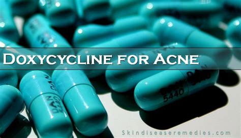 How To Use Doxycycline For Acne Skin Disease Remedies