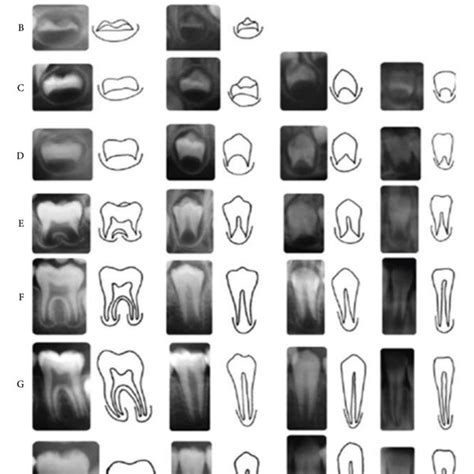 Demirjians Method Of Determining Dental Growth Stages For Estimation Download Scientific