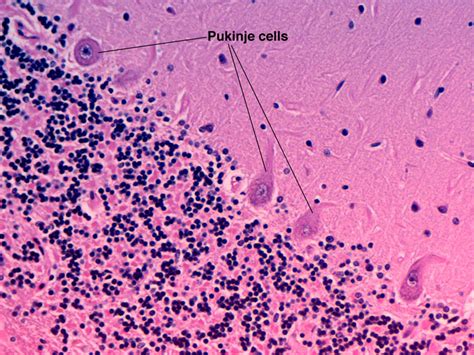Purkinje Cells Histology