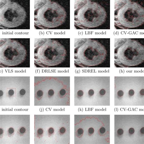 Segmentation Results Of Images With Intensity Inhomogeneity Download Scientific Diagram