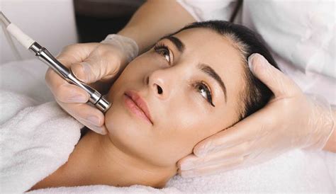 Microdermabrasion Vs Microneedling Essential Differences