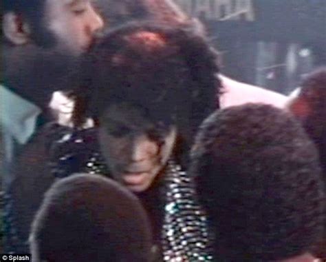 Watch The Unseen Footage Of Michael Jacksons Hair On Fire In Horrific