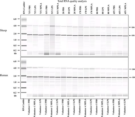Total Rna Quality Analysis Quality Of The Purified Rna Was Assessed By Download Scientific